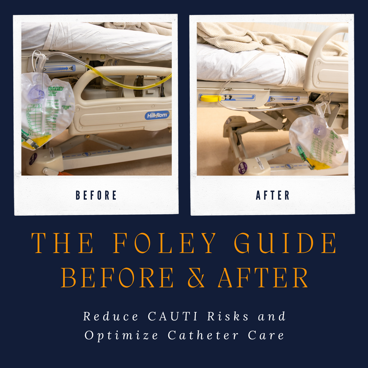 The Foley Clip – Patented CAUTI Prevention Clip | Eliminates Dependent ...