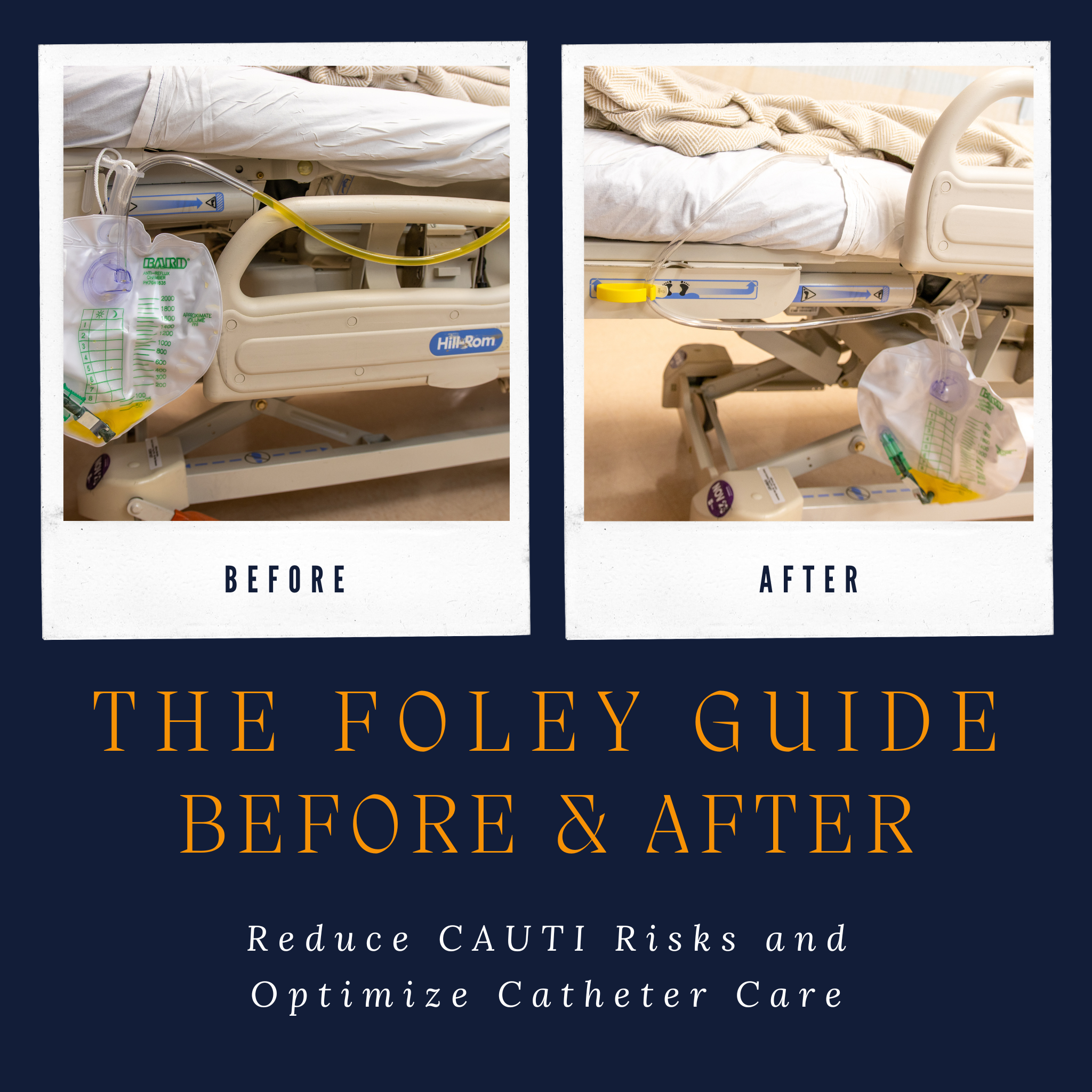 The Foley Clip – Patented CAUTI Prevention Clip | Eliminates Dependent ...